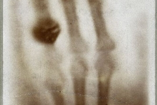 The 20 most fascinating accidental inventions - X-ray images ...