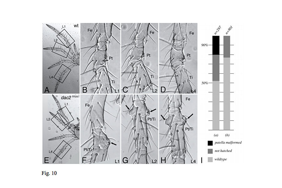 How the spider got his knees - CSMonitor.com